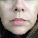 Is my cheekbones and skull so asymmetrical? (photos) Doctor Answers, Tips