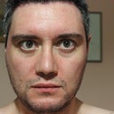 What are the signs of compromised blood flow? (photo) Doctor Answers, Tips