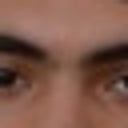 My left eyebrow is higher than my right, what should I do? (Photo ...